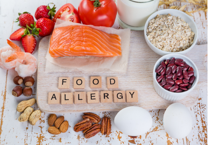 Food Allergy: What You Need to Know - MaNaDr Medical Notes - Manadr