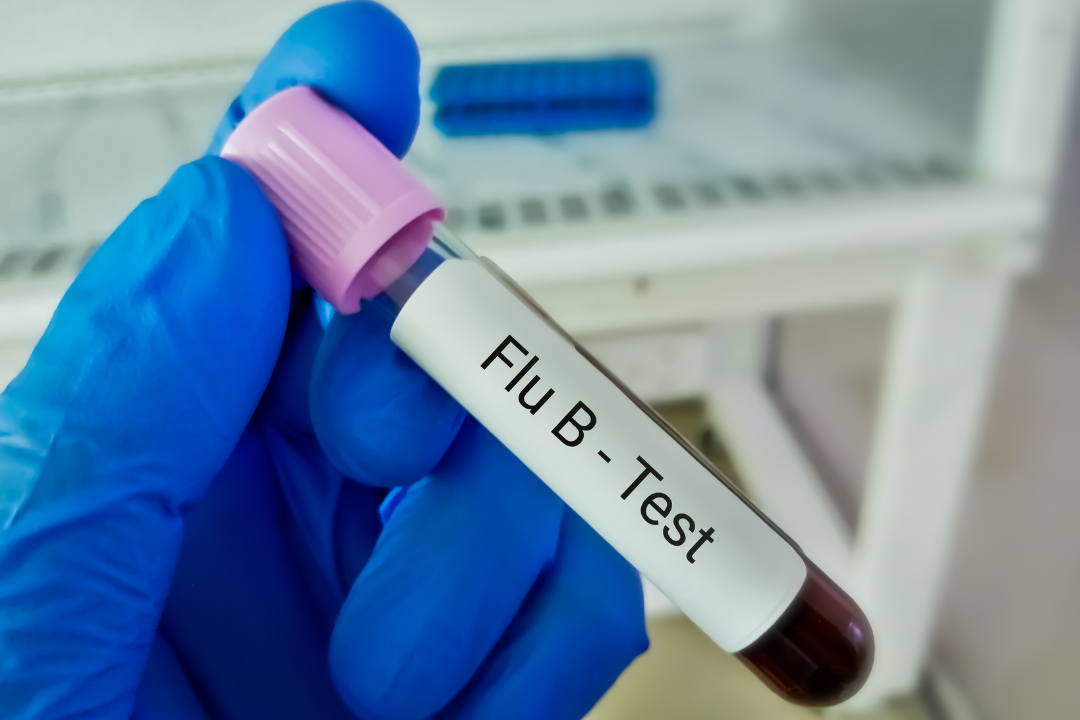 All About Influenza B: What Is Flu Type B, Symptoms, Treatment... - Manadr